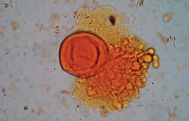 Revista Electronica Fácil: Nuevo parásito intestinal descubierto en ...